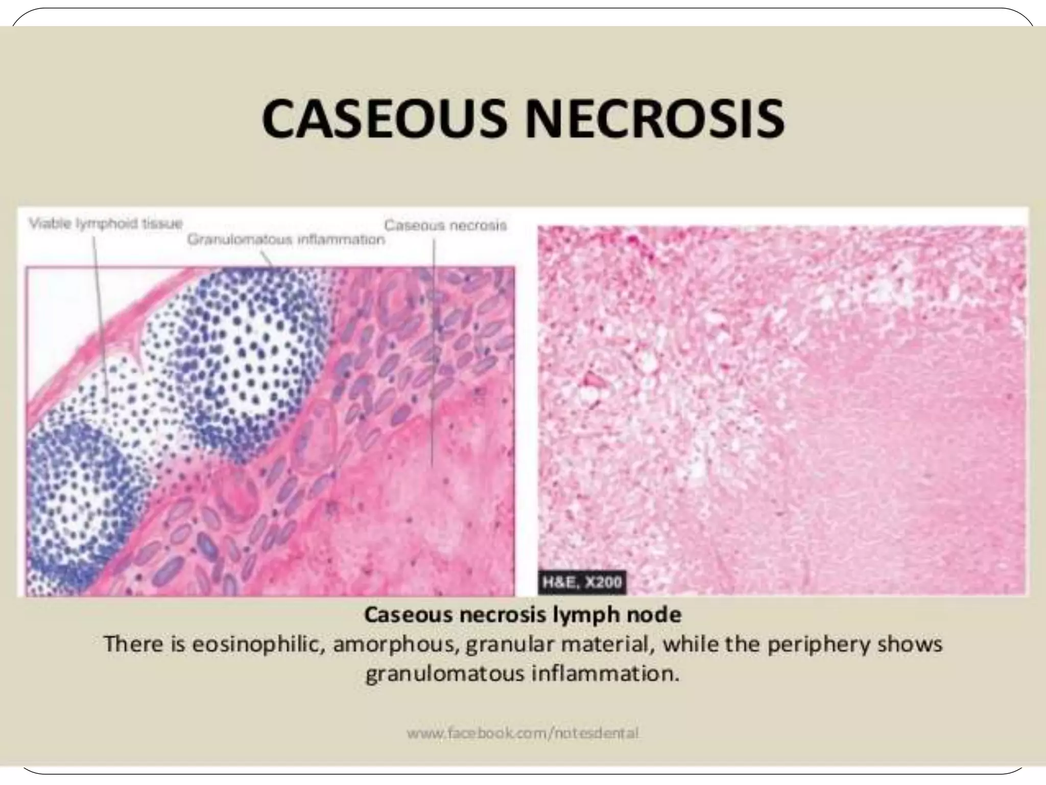 GENERAL PATHOLOGY OF CELL DEATH OF NECROSİS. | PPT