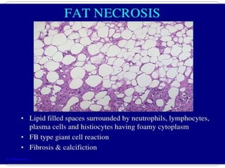 GENERAL PATHOLOGY OF CELL DEATH OF NECROSİS. | PPT