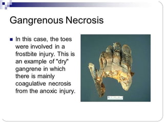 GENERAL PATHOLOGY OF CELL DEATH OF NECROSİS. | PPT