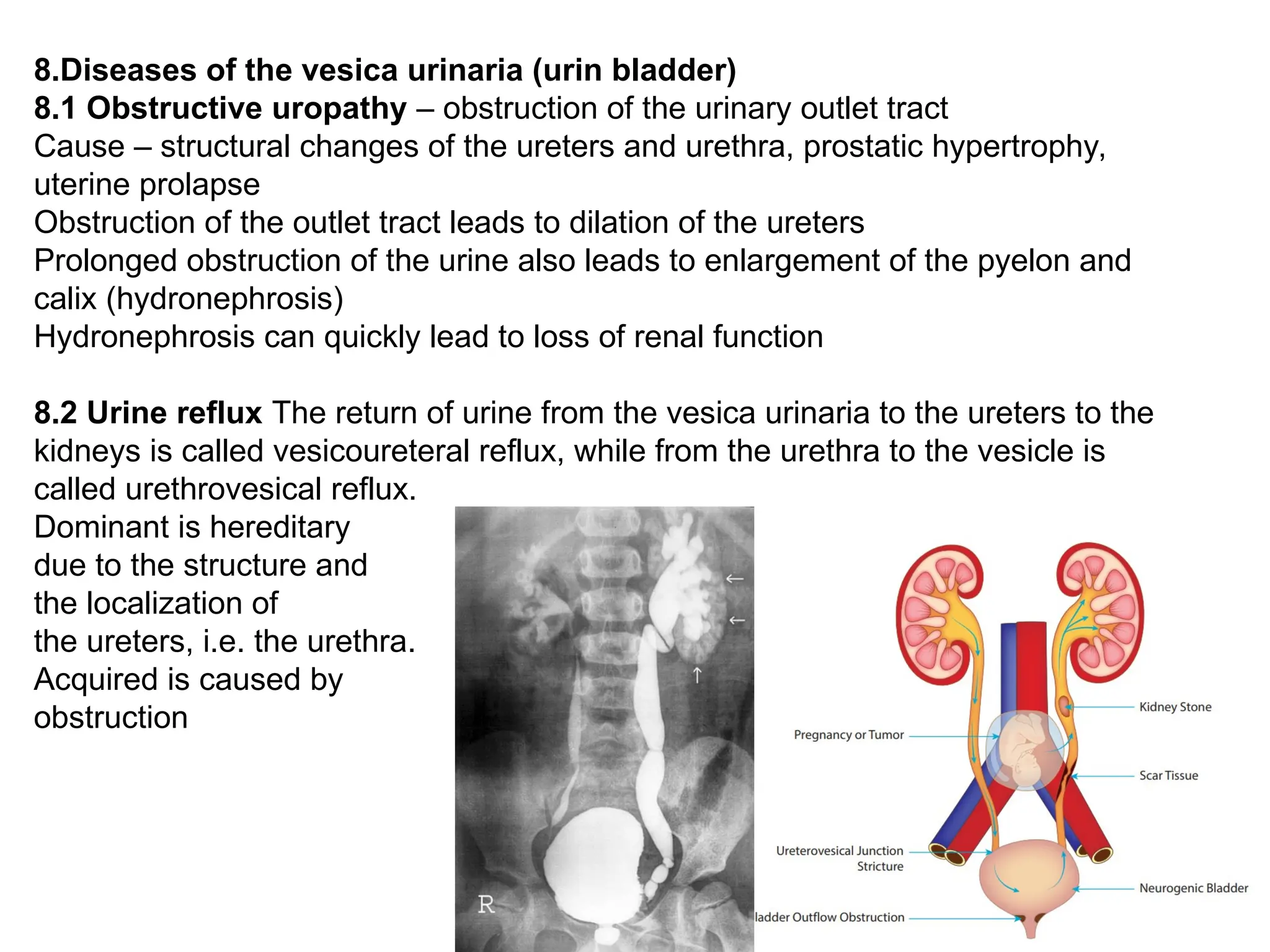 Patophisiology of urinary system Assoc prof Tanja Angjusheva.ppt