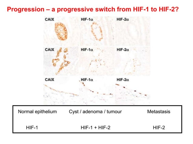 HIF in cell Biology & Physiology | PPT