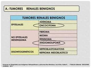 Patron ecograficos de tumores renales | PPTX