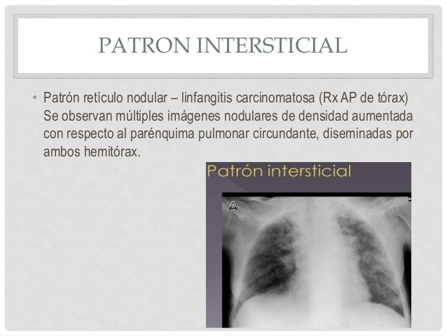 Patrones basicos radiograficos MAS