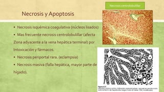 Patrones de daño hepático | PPTX