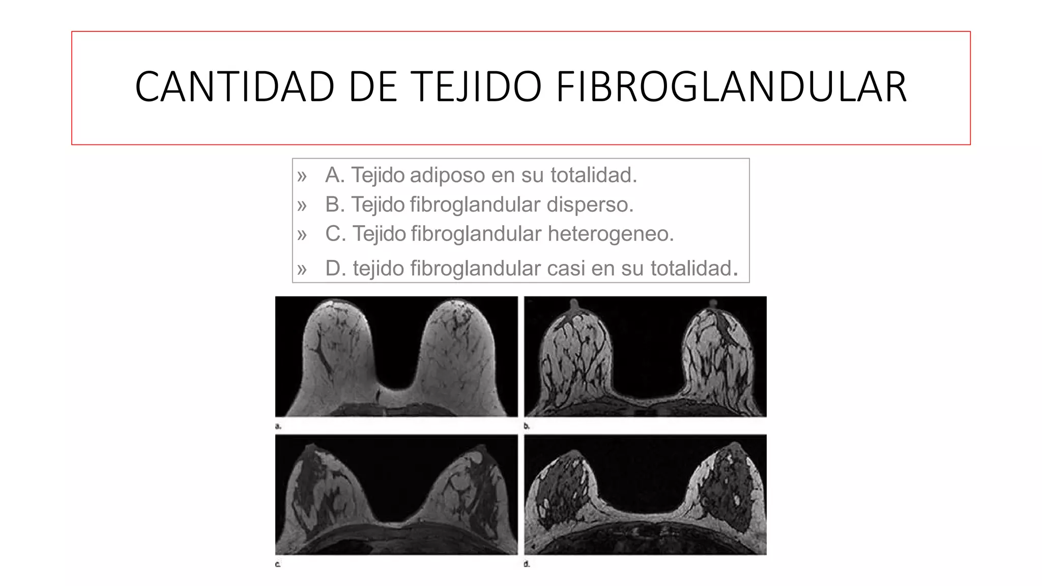 PATRONES GLANDULARES Y LESIONES BÁSICAS - IMAGENOLOGÍA MAMARIA | PDF