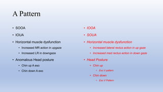 pattern deviations.pptx | Eye and Vision Conditions | Diseases and ...