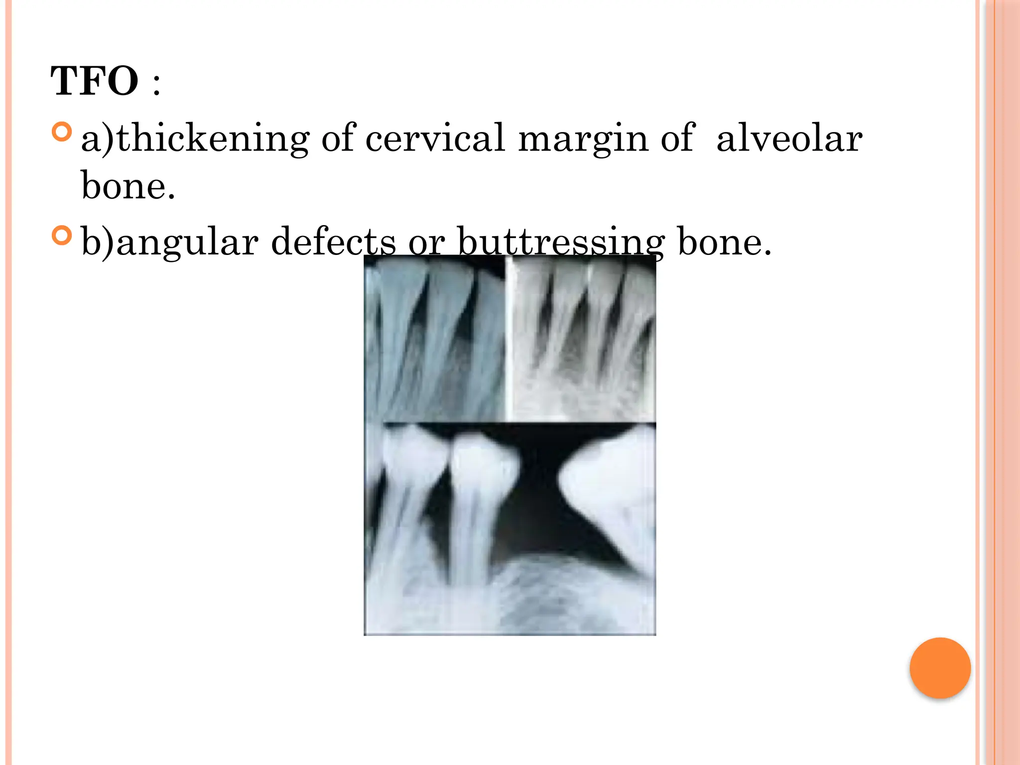 Bone loss and pattern of bone destruction .pptx