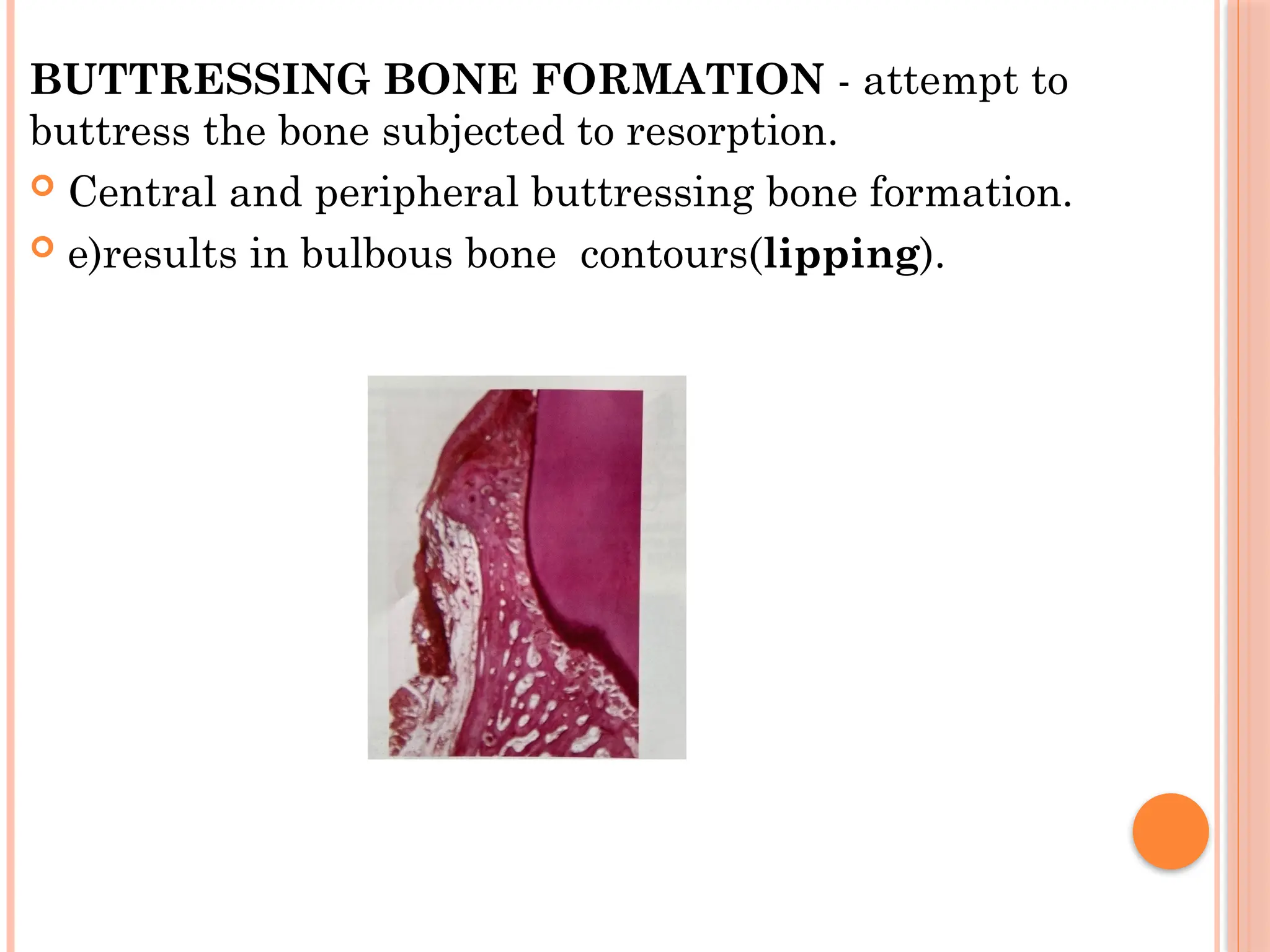 Bone loss and pattern of bone destruction .pptx