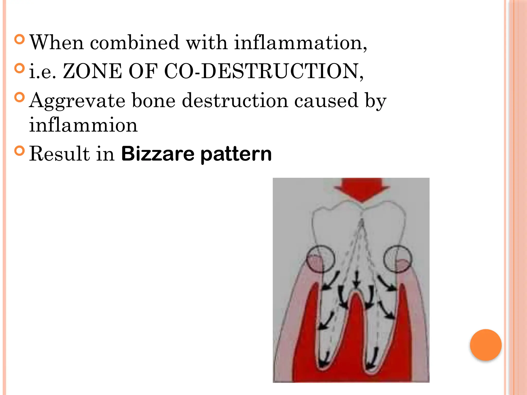 Bone loss and pattern of bone destruction .pptx