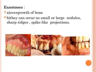 Bone loss and pattern of bone destruction .pptx