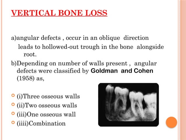 Bone loss and pattern of bone destruction .pptx