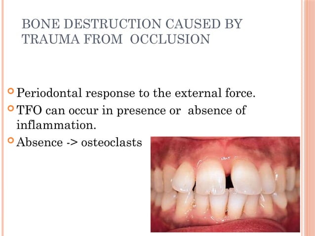 Bone loss and pattern of bone destruction .pptx