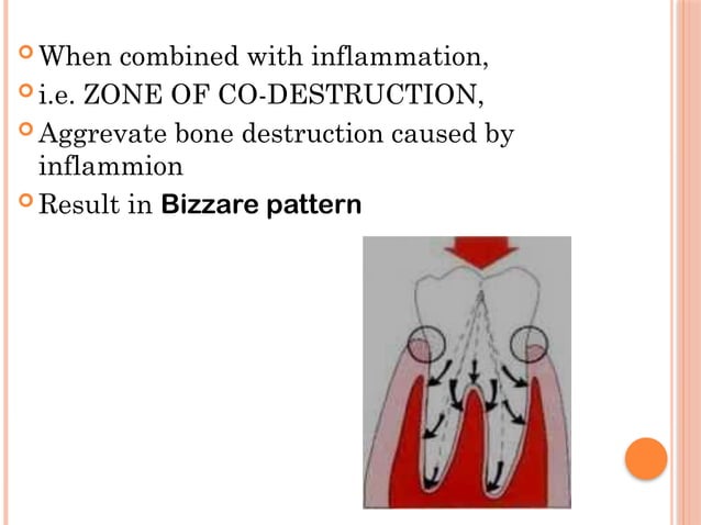 Bone loss and pattern of bone destruction .pptx