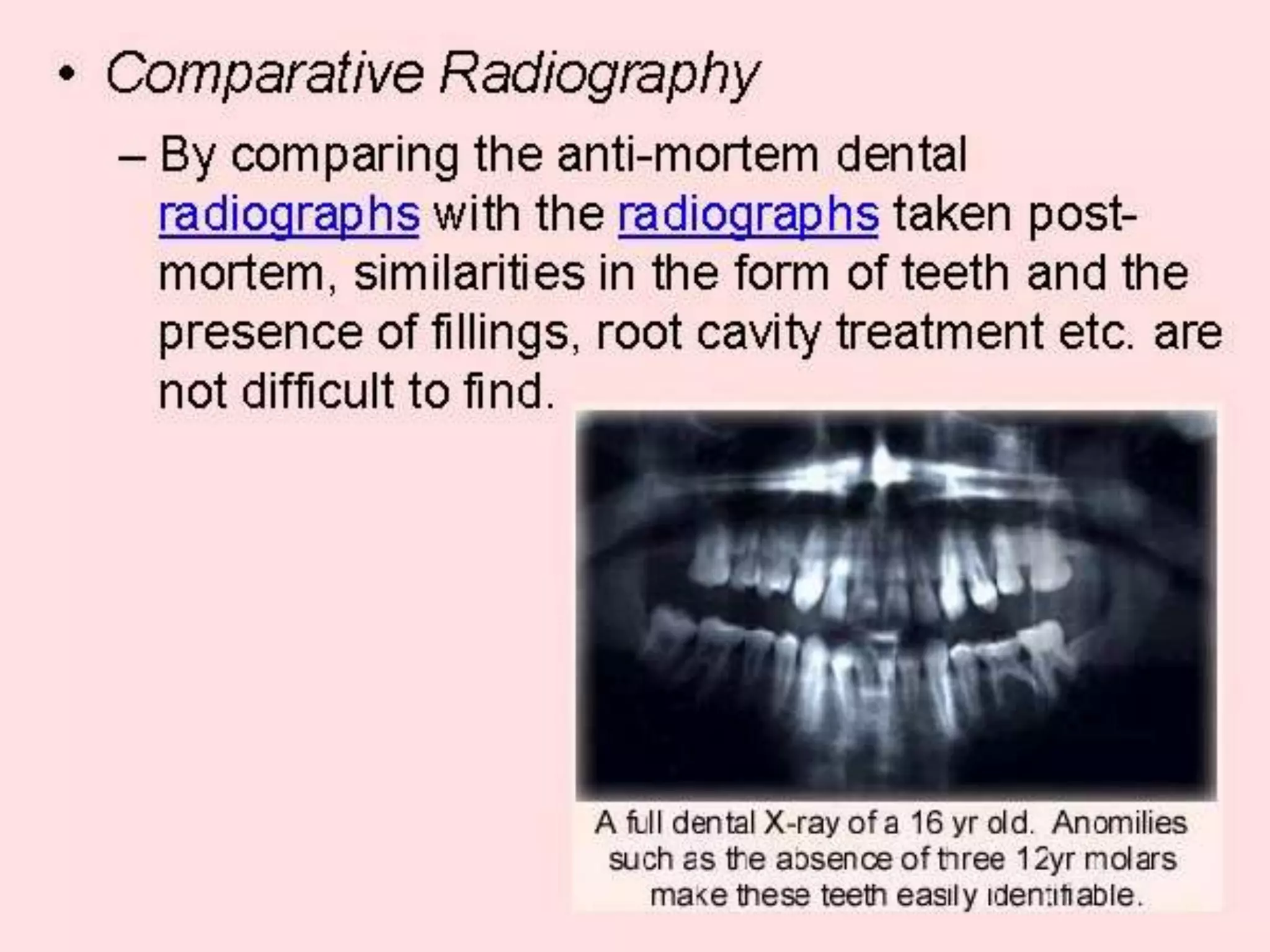 Pattern recognition forensic dental identification | PPTX