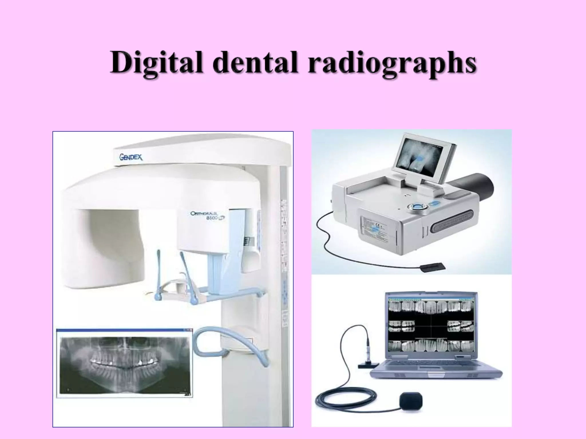 Pattern recognition forensic dental identification | PPTX