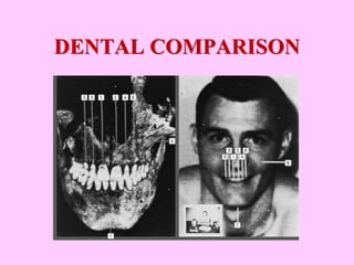 Pattern recognition forensic dental identification | PPT