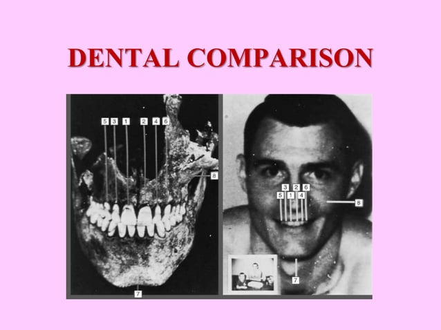 Pattern recognition forensic dental identification | PPT