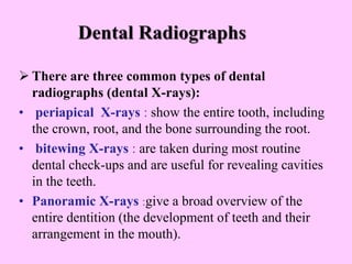 Pattern recognition forensic dental identification | PPT