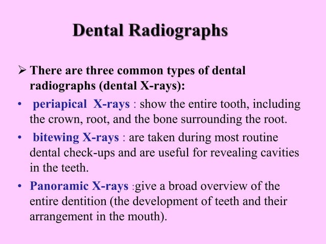 Pattern recognition forensic dental identification | PPT