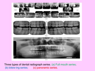 Pattern recognition forensic dental identification | PPTX