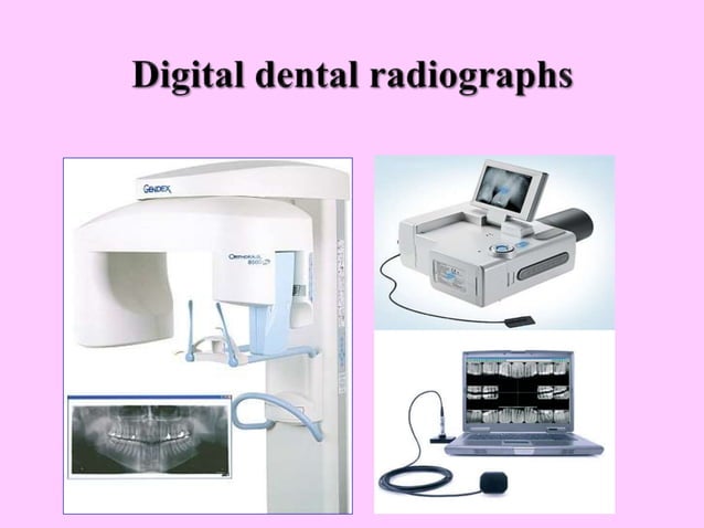 Pattern recognition forensic dental identification | PPT