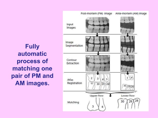 Pattern recognition forensic dental identification | PPT