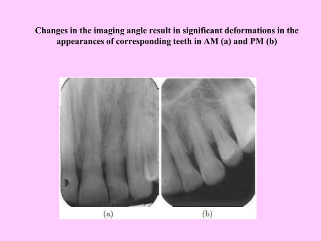 Pattern recognition forensic dental identification | PPT