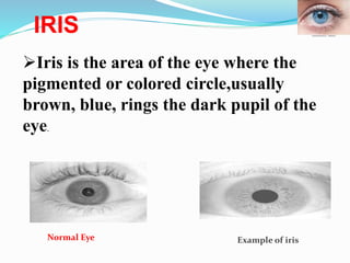 Pattern recognition IRIS recognition | PPTX