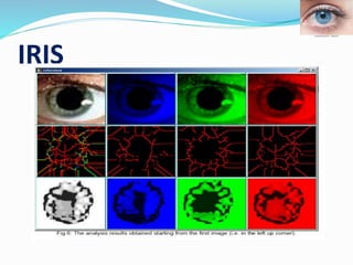 Pattern recognition IRIS recognition | PPTX