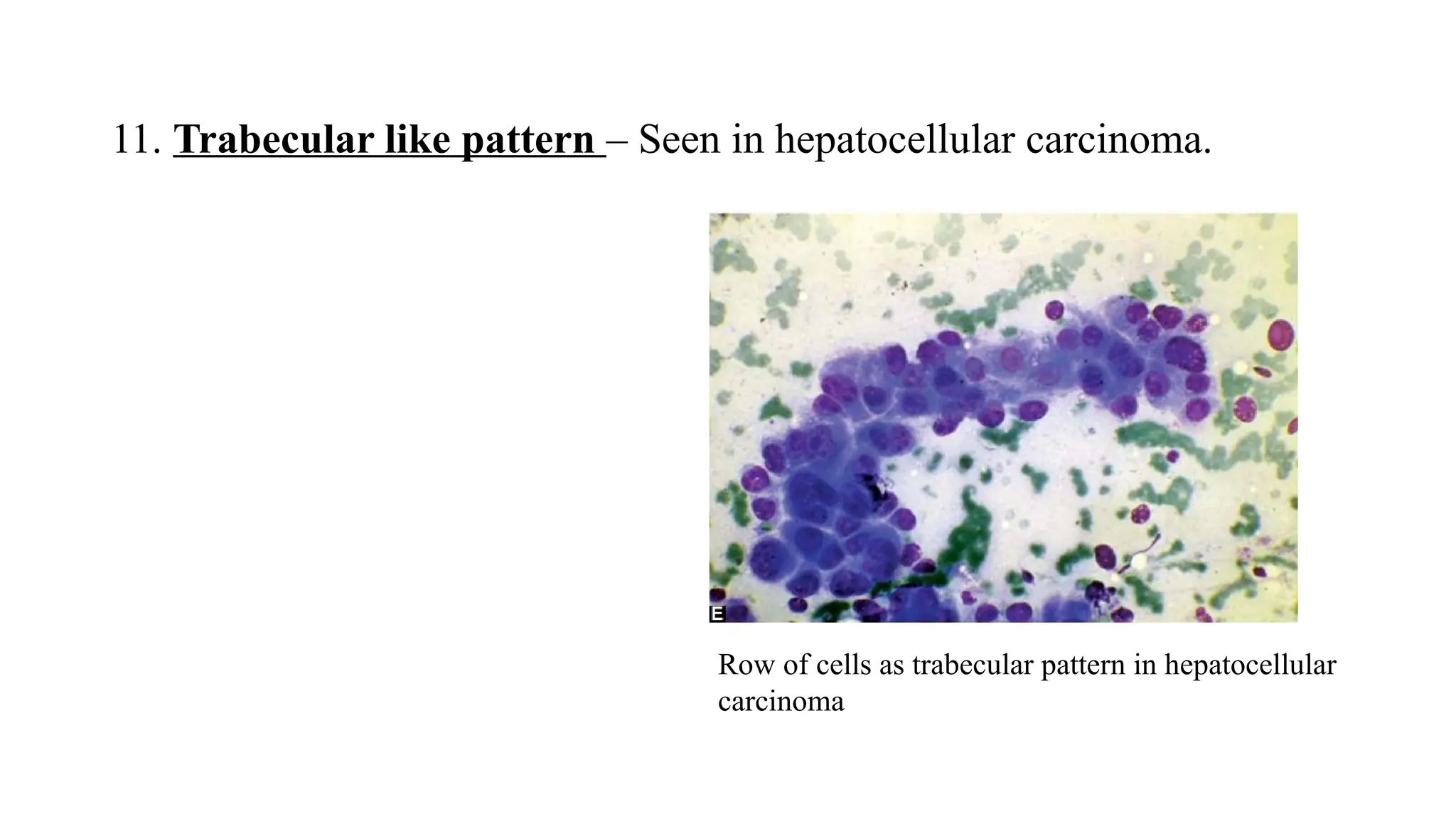 Cytopathological pattern in cytology pathology | PPT