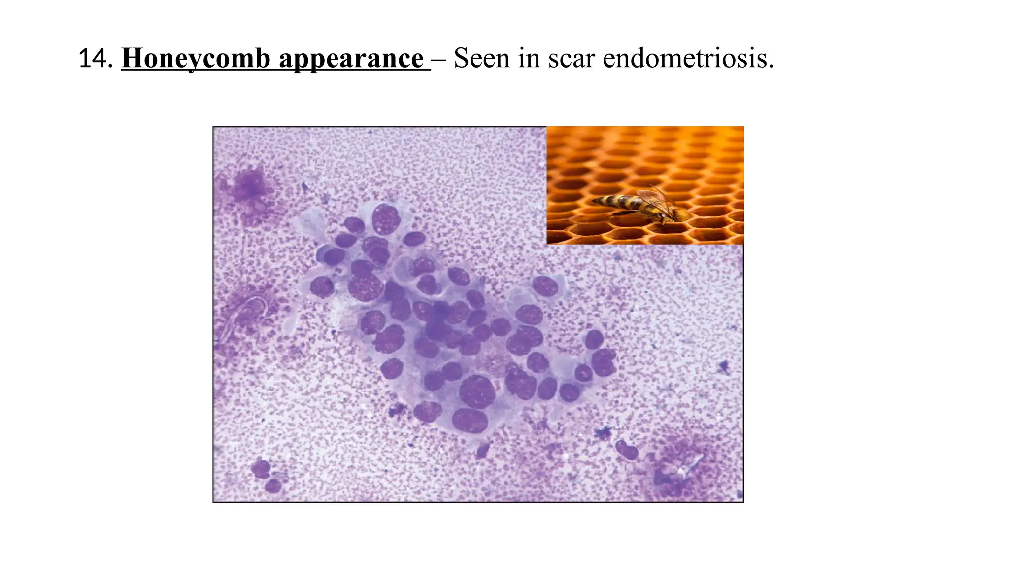 Cytopathological pattern in cytology pathology | PPT