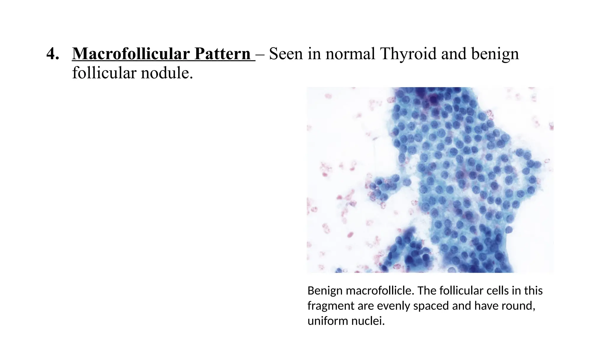 Cytopathological pattern in cytology pathology | PPT