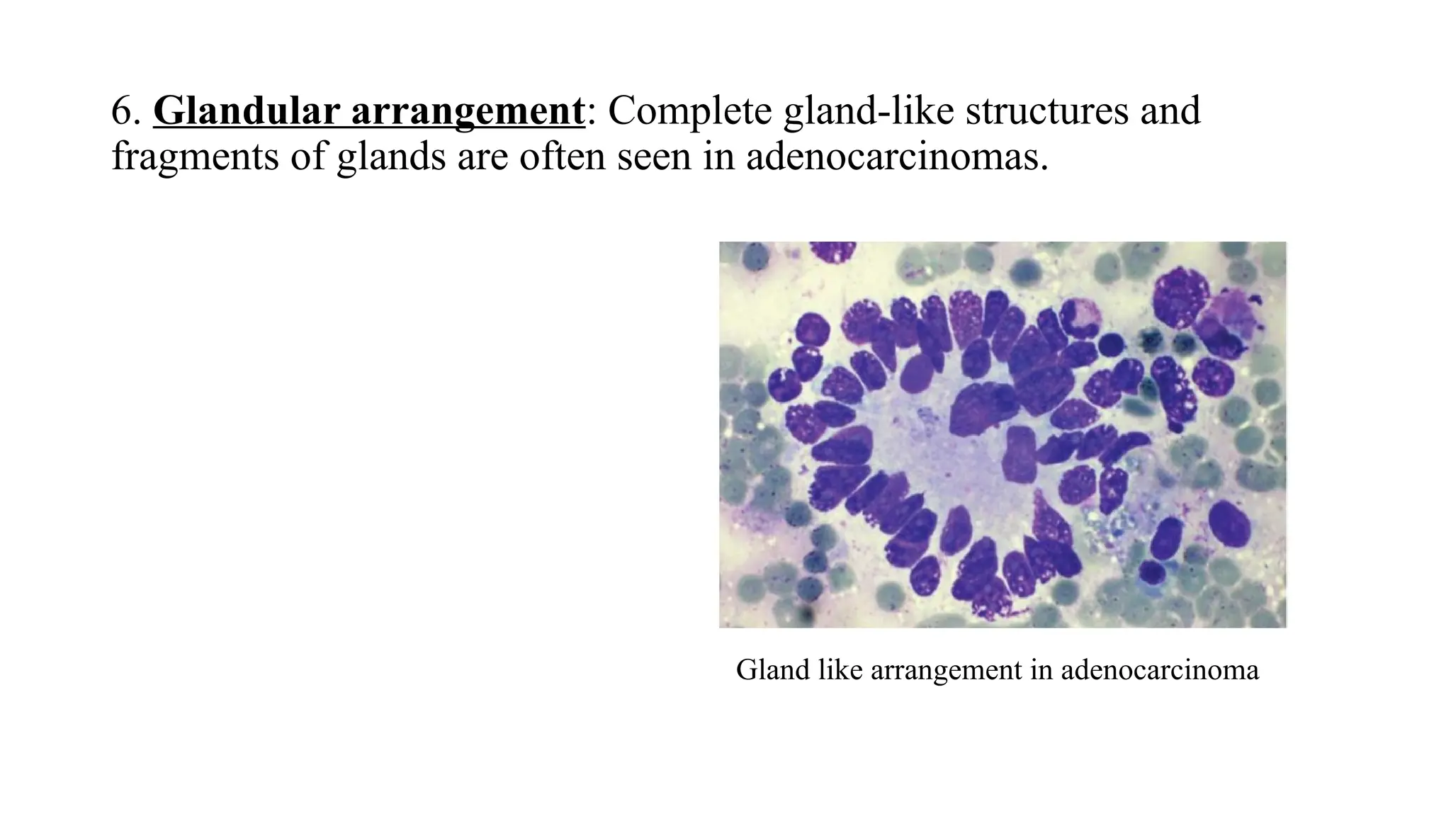 Cytopathological pattern in cytology pathology | PPT