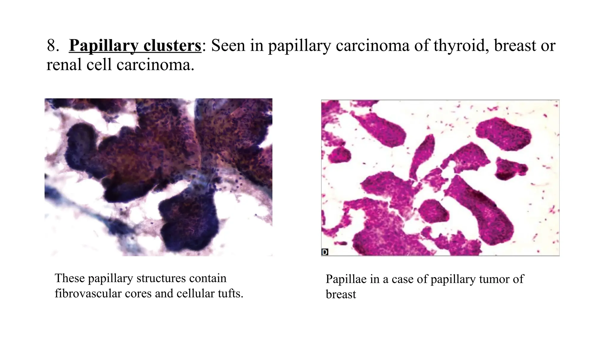 Cytopathological pattern in cytology pathology | PPT