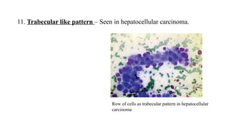 Cytopathological pattern in cytology pathology | PPT