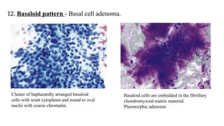 Cytopathological pattern in cytology pathology | PPT