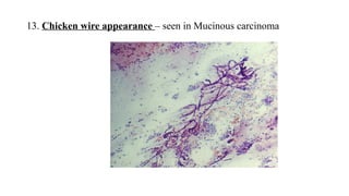 Cytopathological pattern in cytology pathology | PPT