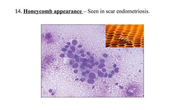 Cytopathological pattern in cytology pathology | PPT