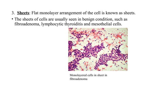 Cytopathological pattern in cytology pathology | PPT