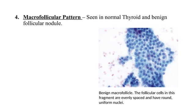 Cytopathological pattern in cytology pathology | PPT