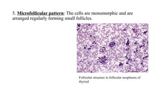 Cytopathological pattern in cytology pathology | PPT