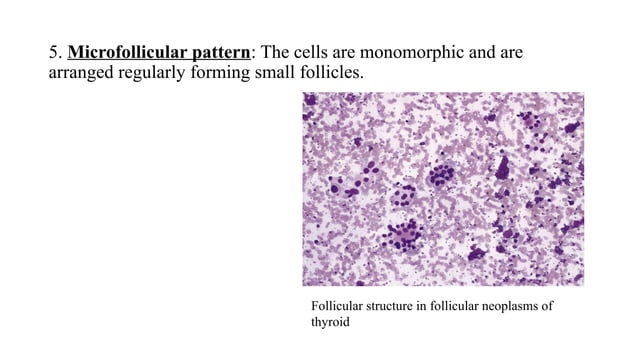 Cytopathological pattern in cytology pathology | PPT