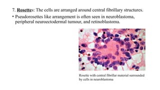 Cytopathological pattern in cytology pathology | PPT