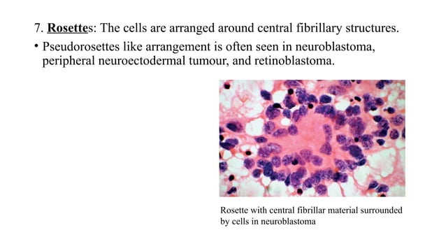 Cytopathological pattern in cytology pathology | PPT