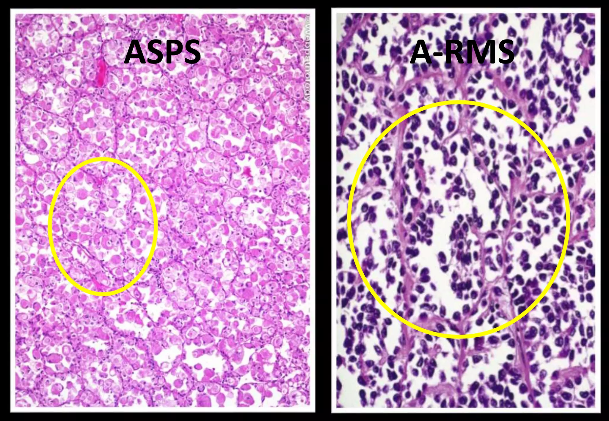 Patterns in histopathology | PPTX