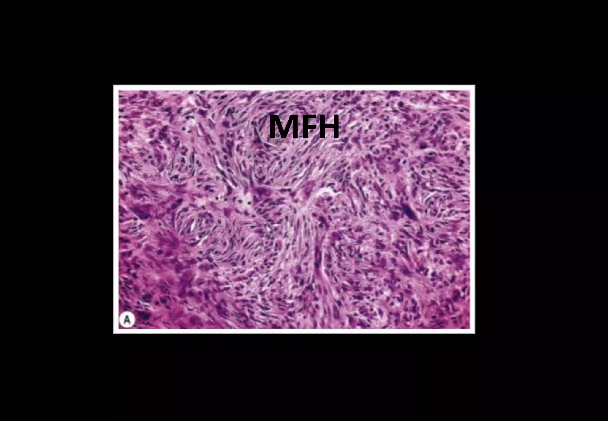 Patterns in histopathology | PPTX