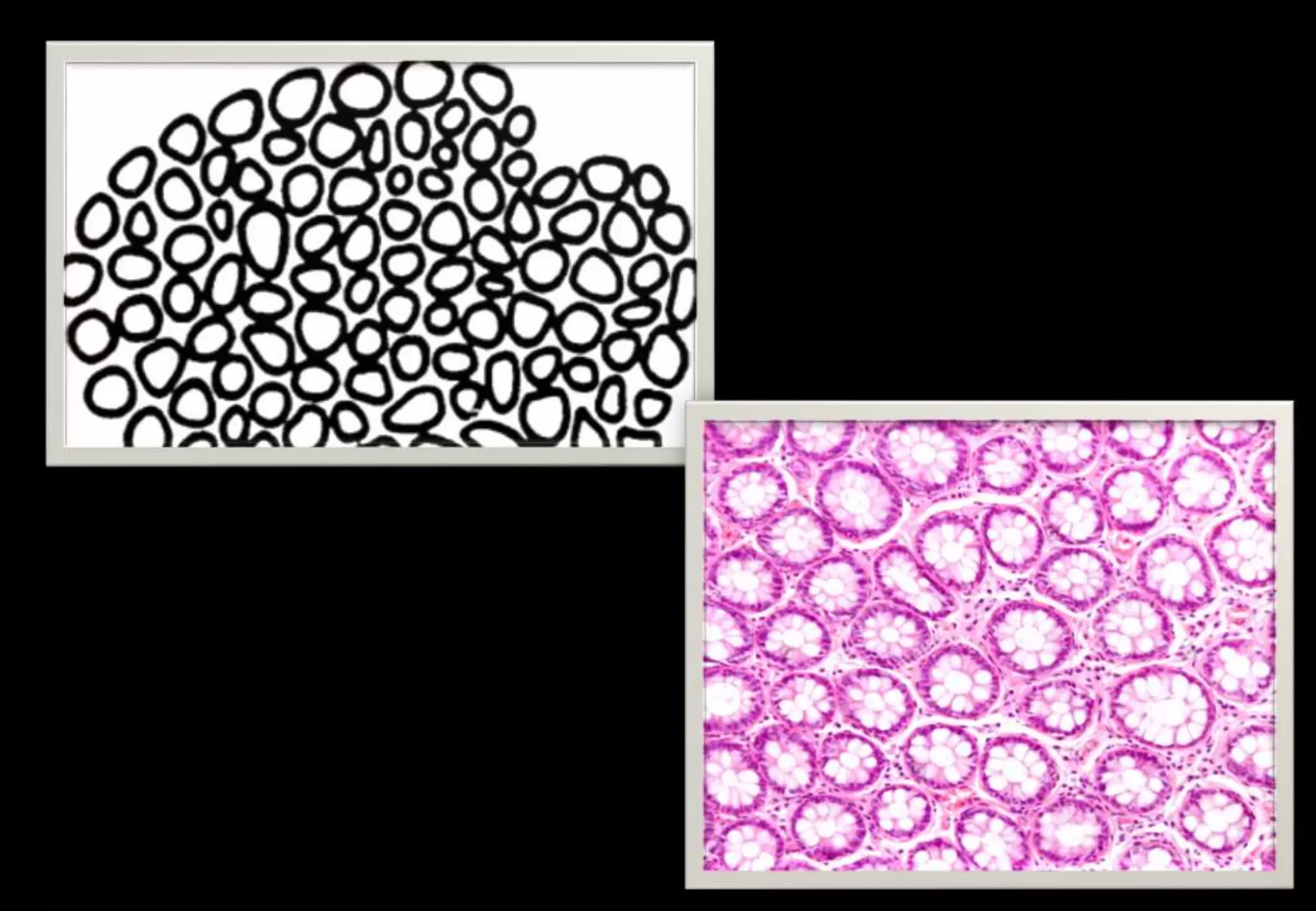 Patterns in histopathology | PPTX | Lung and Respiratory Health ...