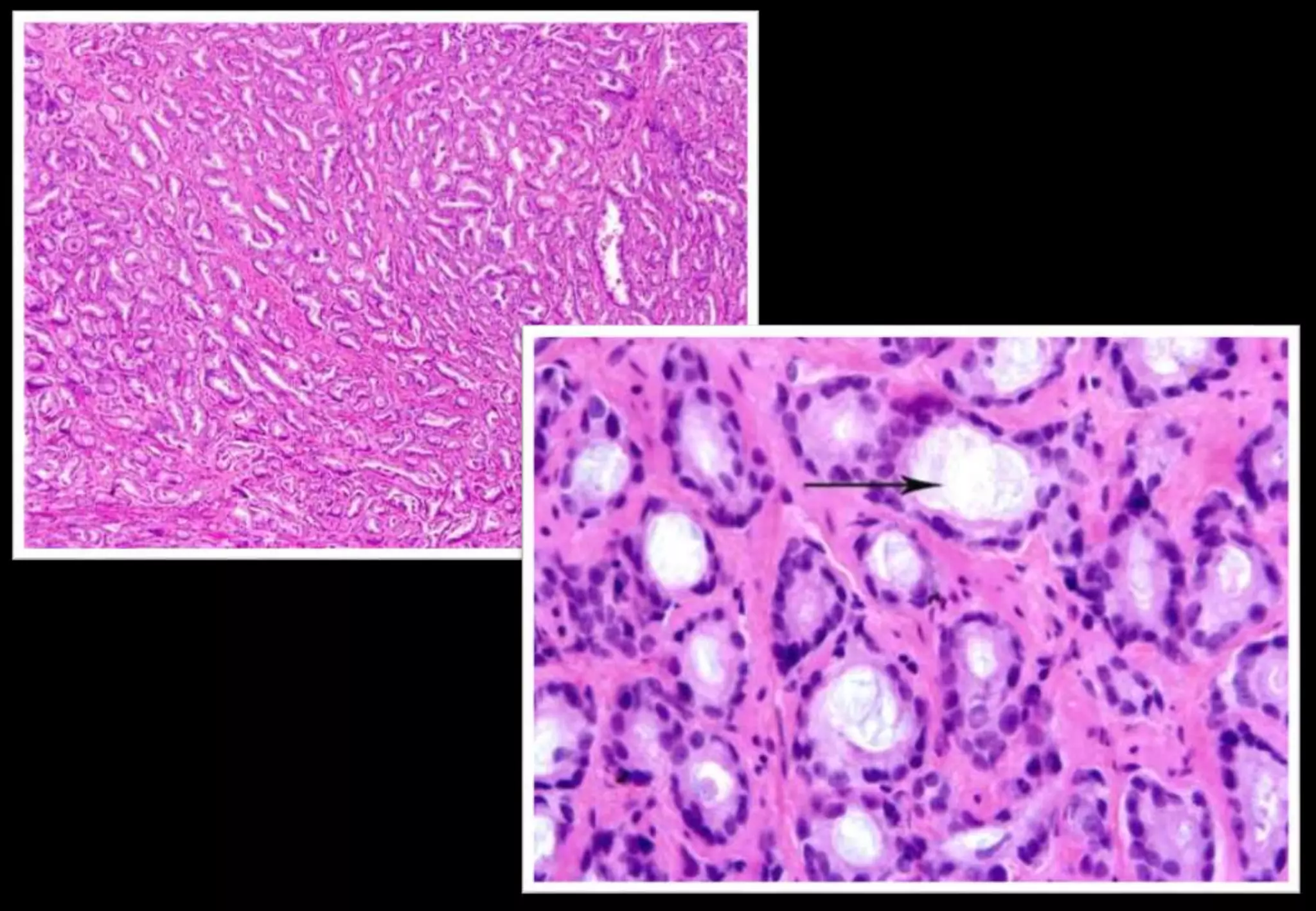 Patterns in histopathology | PPTX