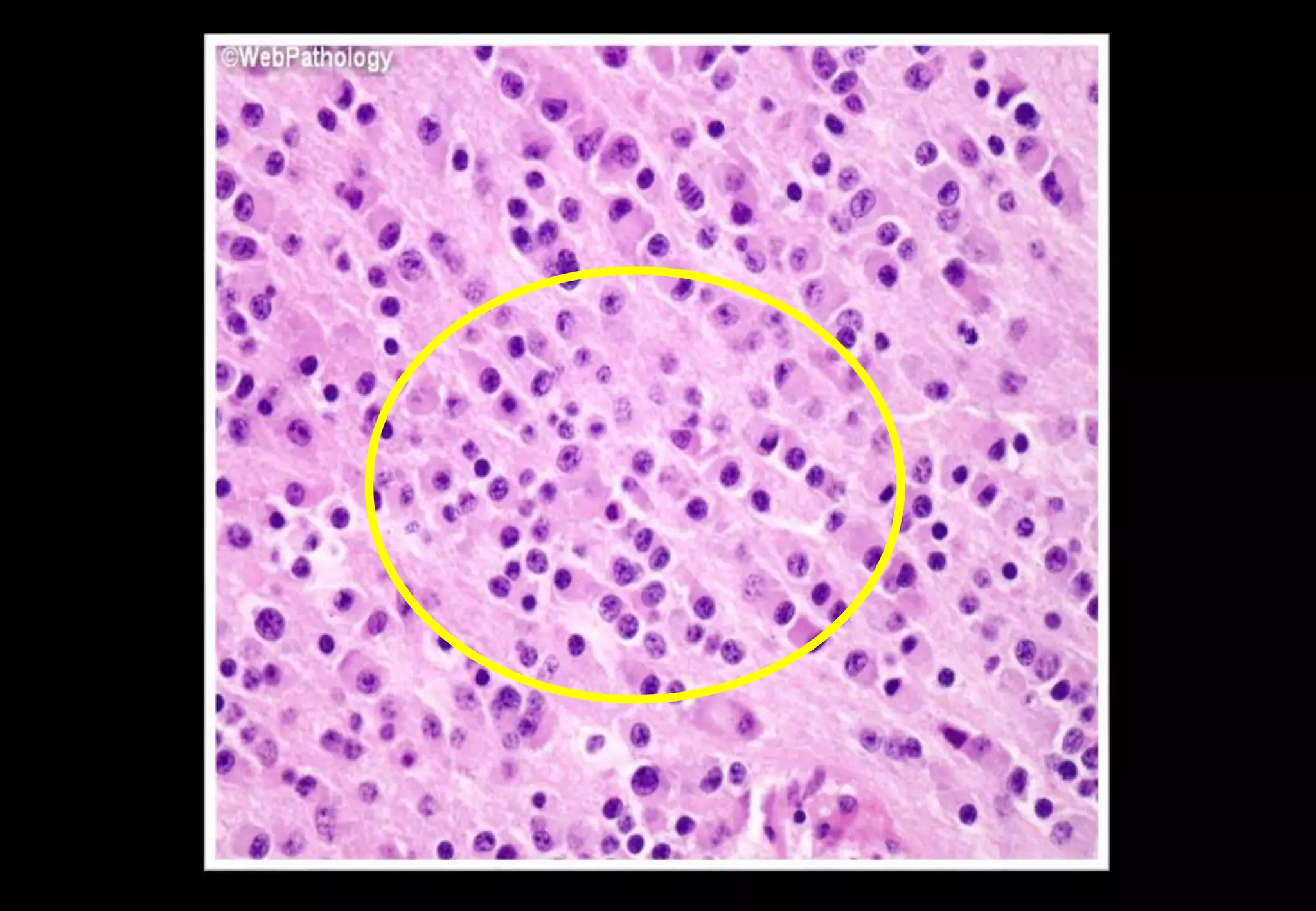 Patterns in histopathology | PPTX