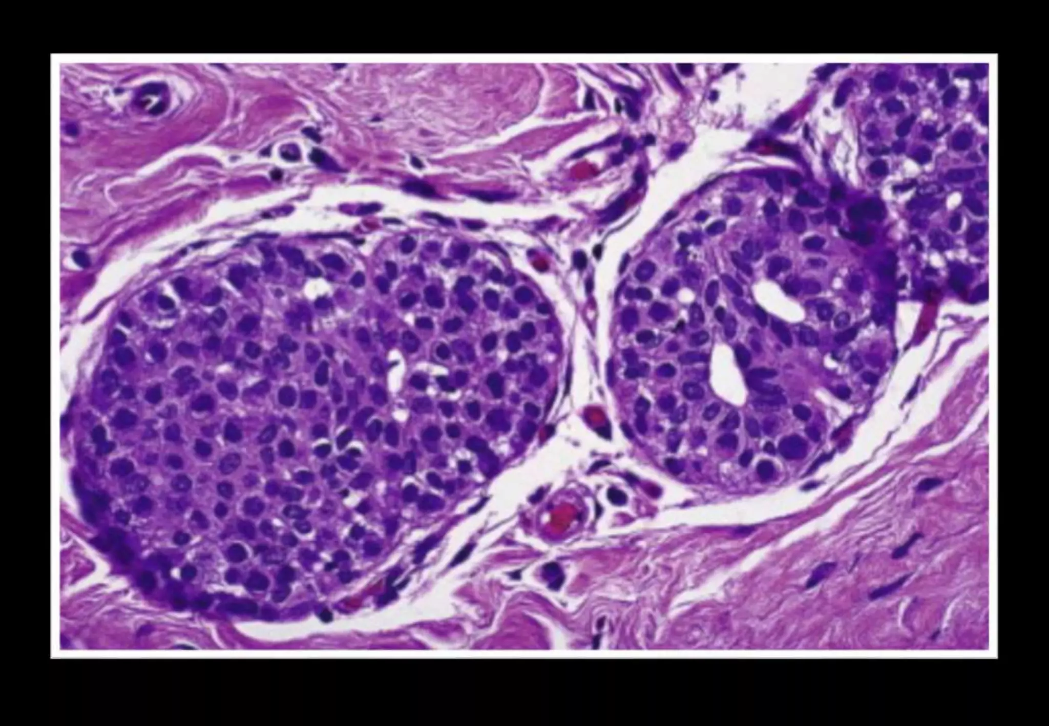 Patterns in histopathology | PPTX